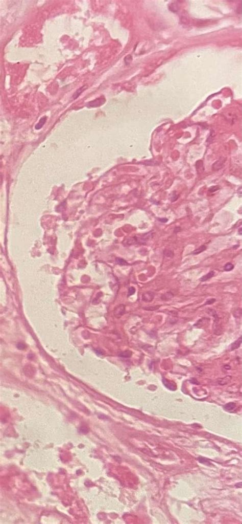 Simple Squamous Tissue Explained