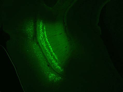 Addgene Aav Data Hub Paavsyngcamp6swpresv40 In Mouse Aav1