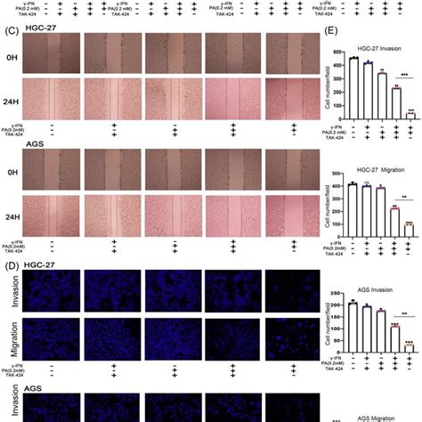 The Tlr4 Signaling Pathway Mediates The Migration And Invasion Of Gc Download Scientific