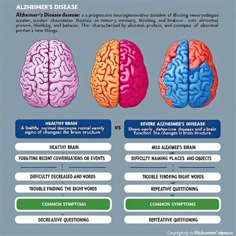 Alzheimers Disease Informative Poster Premium Ai Generated Image