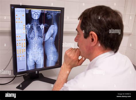Eos Biplanar X Ray Scanner This 2d And 3d Digital X Ray Imaging