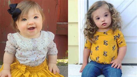 Мајка на девојче со Даунов синдром Засрамена но сега горда