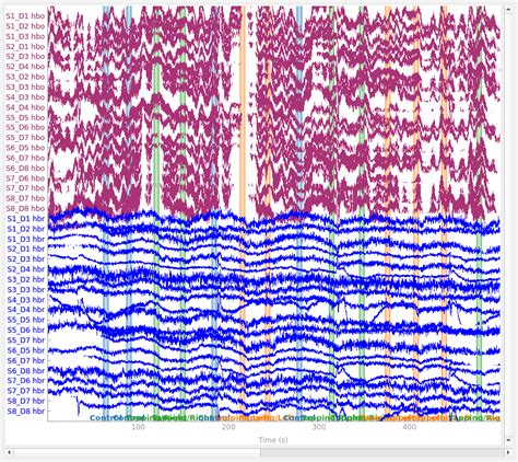 Preprocessing Functional Near Infrared Spectroscopy Fnirs Data — Mne