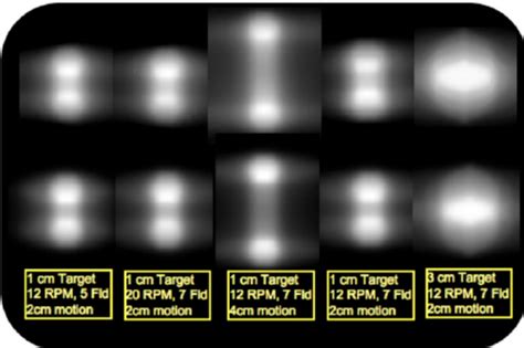 Validation Of The Dose Accumulation Model In The Simulation Framework