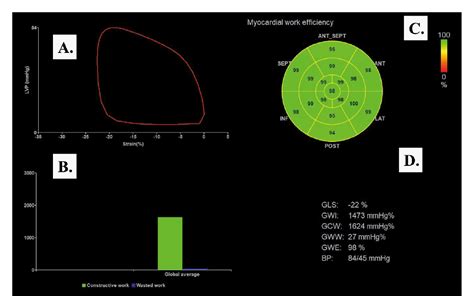 Figure 1 From Echocardiographic Reference Ranges Of Non Invasive Myocardial Work Indices In