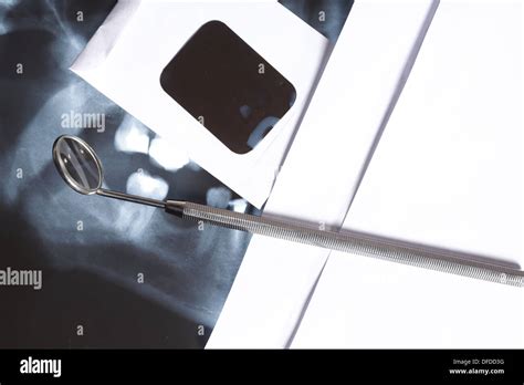 Detail X Ray Image Scan Of Humans Teeth Stock Photo Alamy