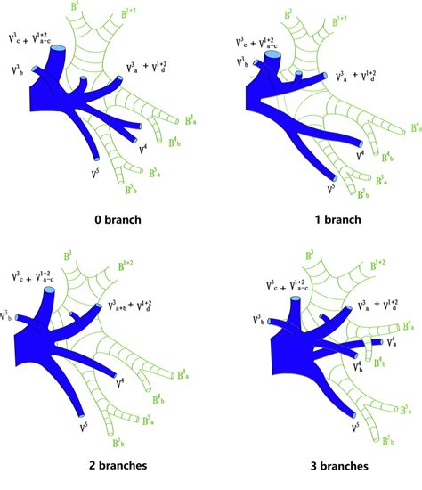 Type Of Lingular Vein According To The Number Of Independent Download Scientific Diagram