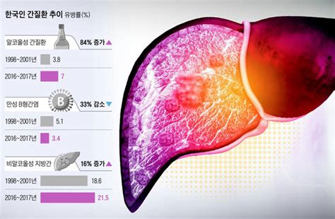 20·30대 술 의존 늘었나 알코올 간질환 급증 당신의 건강가이드 헬스조선
