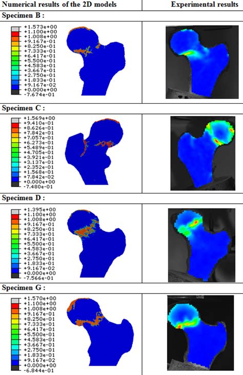 Finite Element Derived From Dxa Image And Experimental Fracture Download Scientific Diagram