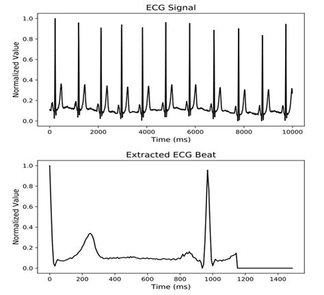 Github Mohdakrory Ai Based Medical Diagnosis System An Ai Based Application That Offers