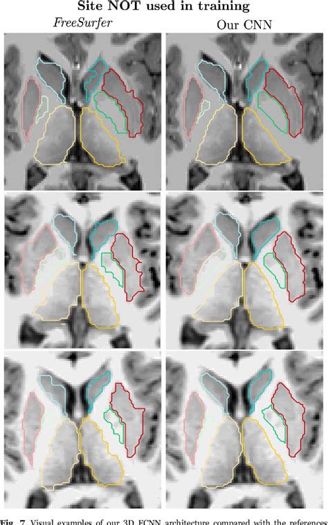 Figure 1 From 3d Fully Convolutional Networks For Subcortical