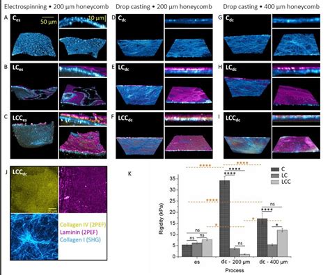 Shg Collagen I In Cyan And 2pef Laminin In Magenta And Collagen Iv Download Scientific