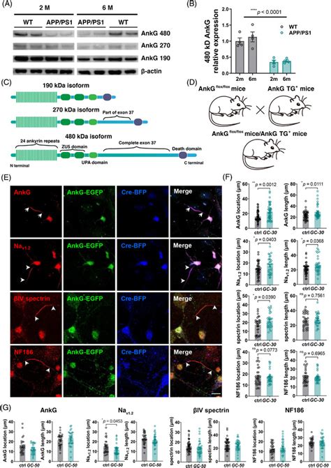 Alterations In The Axon Initial Segment Plasticity Is Involved In Early Pathogenesis In