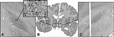 Figure 1 From Towards 3d Reconstruction Of Neuronal Cell Distributions From Histological Human