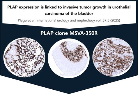 Plap Antibody Immunohistochemistry Pathology Cancerresearch Ms