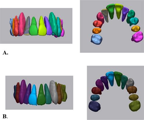 accuracy of deep learning based integrated tooth models by merging