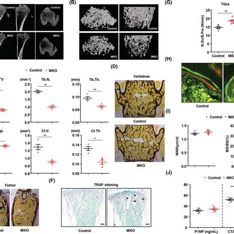 Mitochondrial Stress Response In Skeletal Muscle Promotes Lower Bone Download Scientific