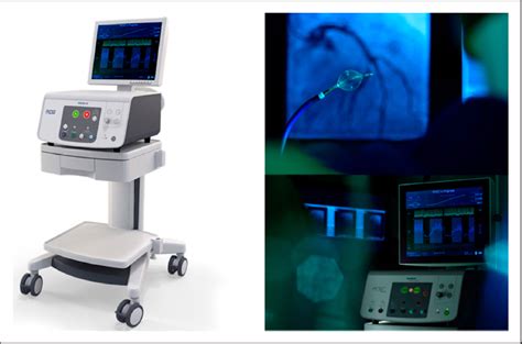 Coronary Sinus Intervention For Retrograde Perfusion Example Of