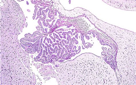 Choroid Plexus Histology
