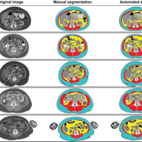 manual and automated segmentation of body composition from ct produces