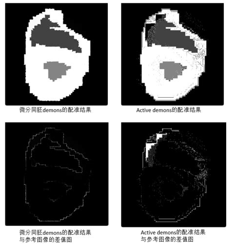 微分同胚demons配准算法原理与c opencv实现 csdn博客