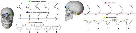 Figure 1 From Sexual Dimorphism Of Cranial Morphological Traits In An Italian Sample A
