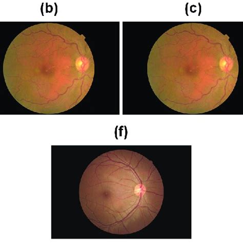 Bert Model Structure Download Scientific Diagram