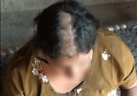 Woman Tonsured By Neighbours In Aligarh On Suspicion Of Sex Trade