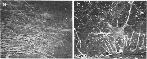 Scanning Electron Micrographs Of Retinal Neurite Outgrowth On Astrocyte Download Scientific