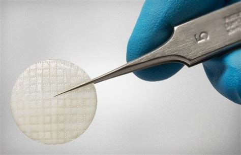 International Cartilage Repair Society Symposia To Highlight Early Findings Of Prochondrix