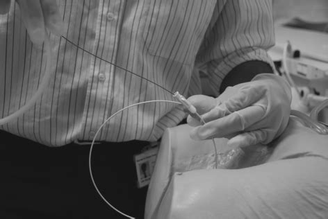 Reducing False Passages A Novel Technique For Difficult Urethral