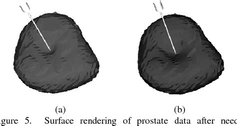 Figure From Compact Support Radial Basis Functions For Soft Tissue Deformation Semantic Scholar