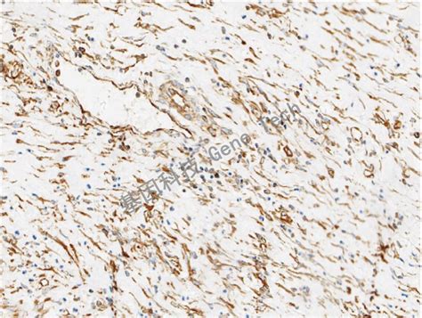 Tubulin β 鼠抗人 微管蛋白β(tubulin β)抗体试剂(免疫组织化学法) Tubulin β 鼠抗人 微管蛋白β(tubulin β)抗体试剂(免疫组织化学法)