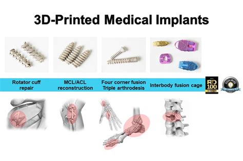 3d Printing Biomimetic Materials And Structures For Tissue Integration Bioms Ti Smart Medtech