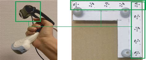 The Optical Marker Placed Onto The Patient Next To The Area Of Interest