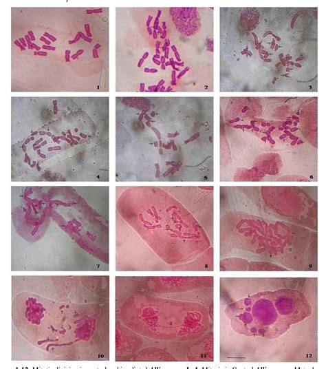 Figure 1 12 From Gamma Radiation Induced Chromosomal Aberrations At