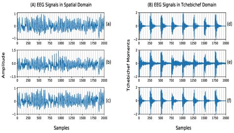 Eeg Signals Visualizations For Bonn Z Database A Spatial Domain Download Scientific