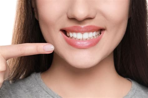Overbite Teeth Solutions Treatment Options For A Brighter Smile