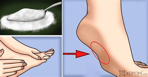 Таныг хэтэрхий их сахар хэрэглэж байгааг бие махбодь тань дараах 5 шинж тэмдгээр анхааруулна