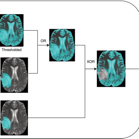 Slic Segmentation Results Row A Represents Different Brain T2 Images Download Scientific