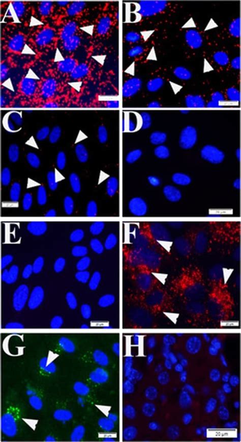 Vinculin Antibody 700062