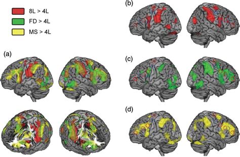 Whole Brain Analysis Overlaid Activation Maps From 3 Whole Brain Download Scientific Diagram