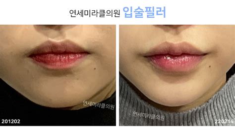 쁘띠and항노화 연세미라클의원