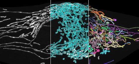 Image Processing Analysis With Imagej Fiji Ooa Oncology Graduate School Amsterdam