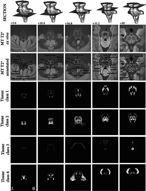 Brainstem Tissue Probability Maps Compared Against High Resolution Ex