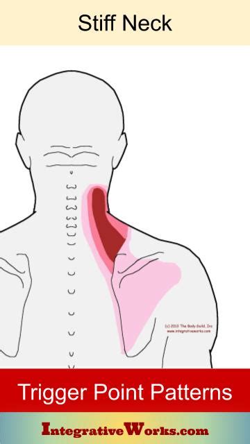 Stiffness On Side Of Neck When Turning Integrative Works
