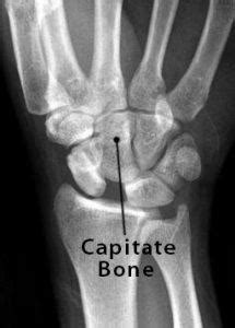 Capitate Bone Definition Location Anatomy Diagram
