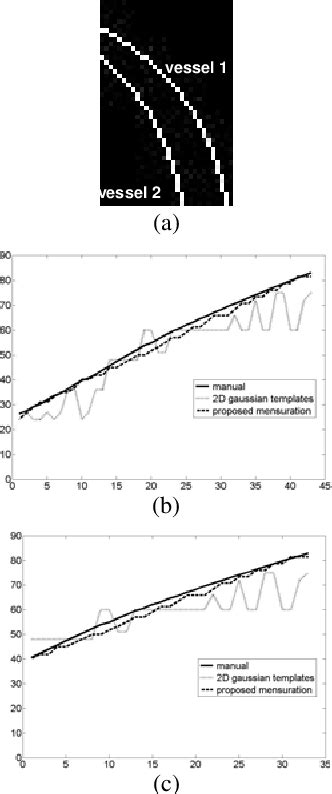 Figure From Vessel Inscribed Trigonometry To Measure The Vessel Progressive Orientations In