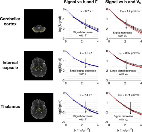 Figure 1 From Diffusion Mri With Free Gradient Waveforms On A High Performance Gradient System