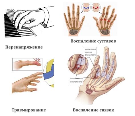 Гигрома на пальце руки
